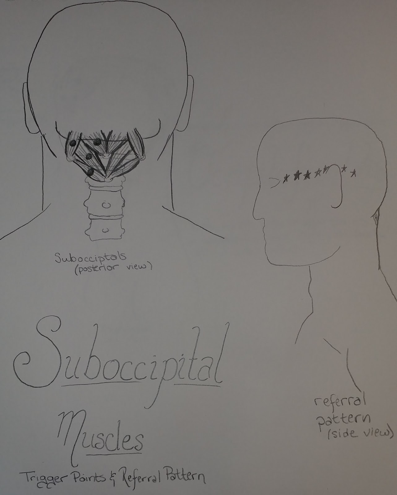 Trigger Points: Suboccipital Muscles