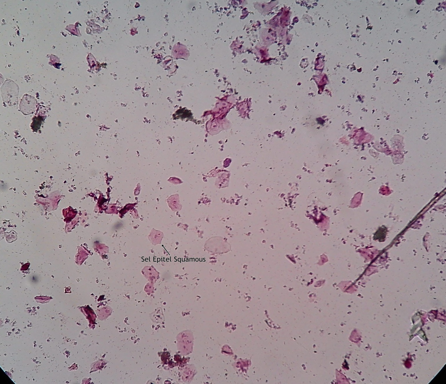 Sedimen Urine (Stainning) | Analis Kesehatan