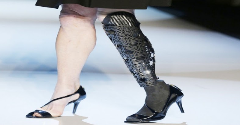 Advantages Of Bionic Body Parts