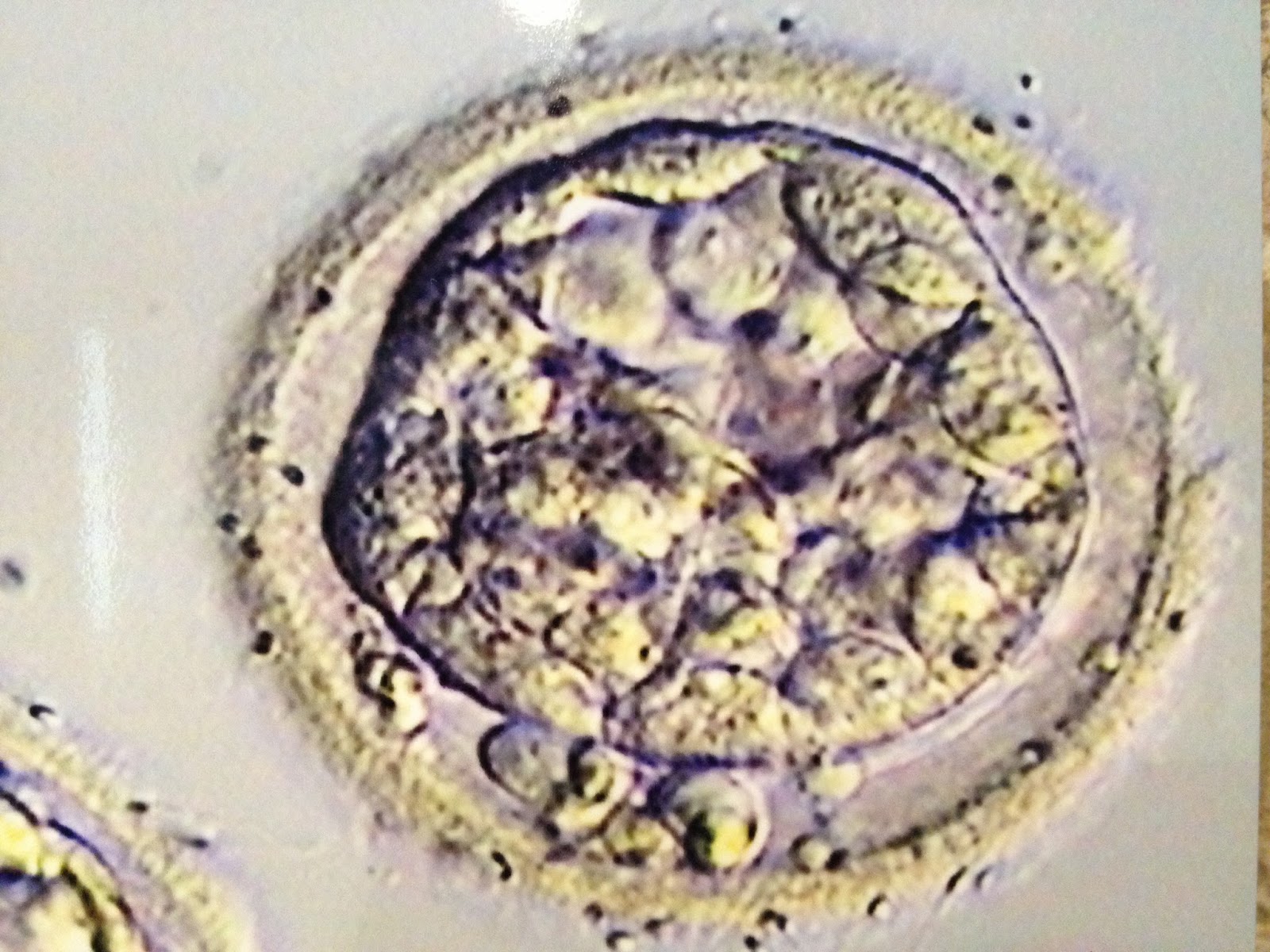 Eat Love Procreate: Fertile Turtles & Hatching Embryos