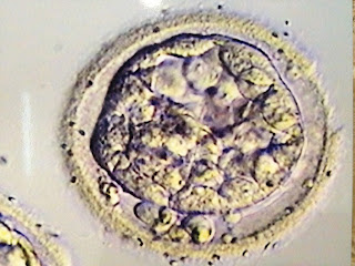 Eat Love Procreate: Fertile Turtles & Hatching Embryos