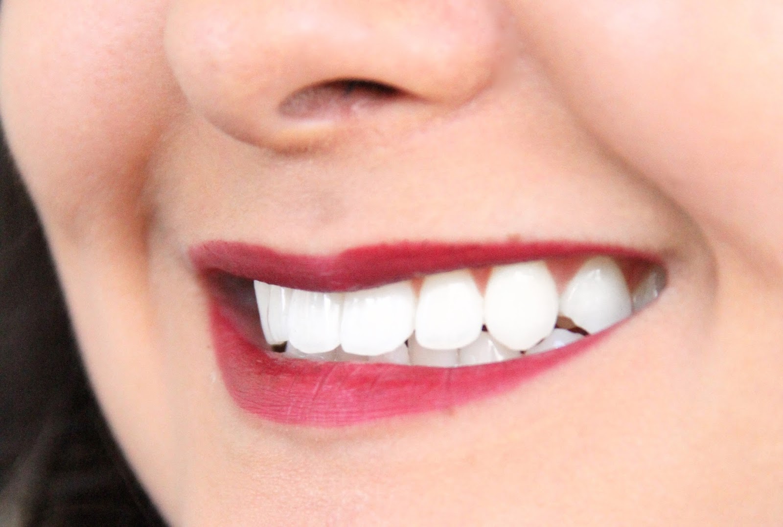 Smile Brilliant: Custom Teeth Whitening System + Giveaway - Elizabeth ...