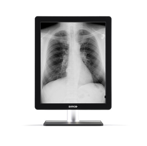 BARCO LCD DIGITAL SOLUTION ~ Lumary Birumas