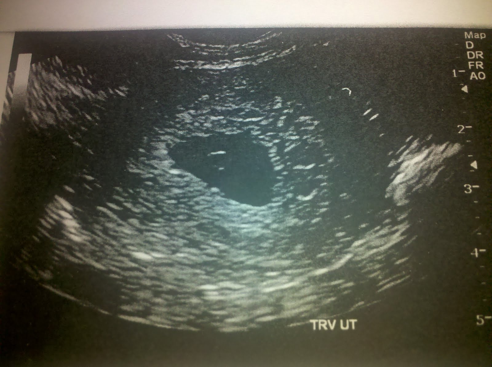 January 2012 Moms: Ultrasound Gallery