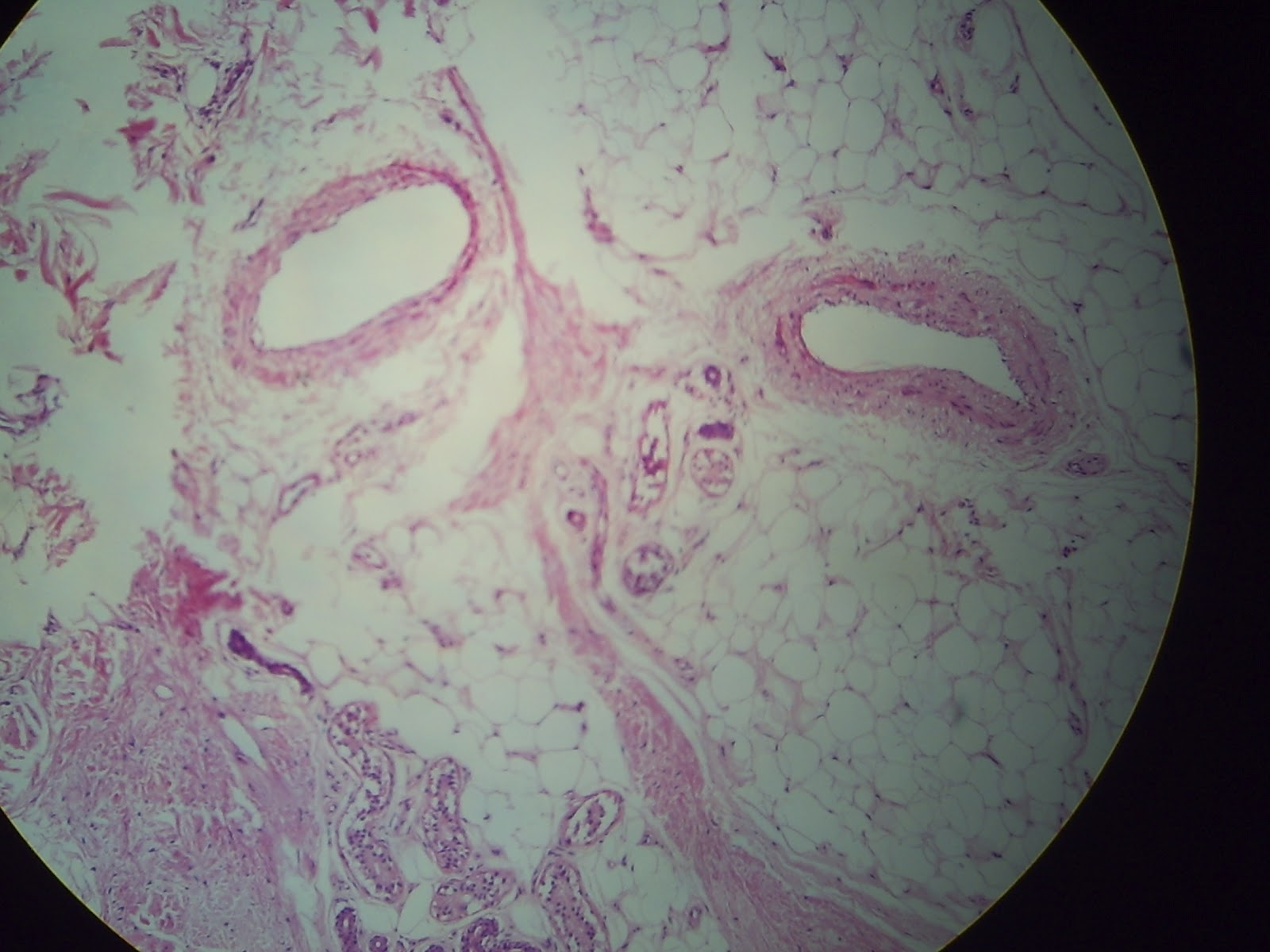 MEDICINA USMP: FOTOS DE HISTO SISTEMA NERVIOSO