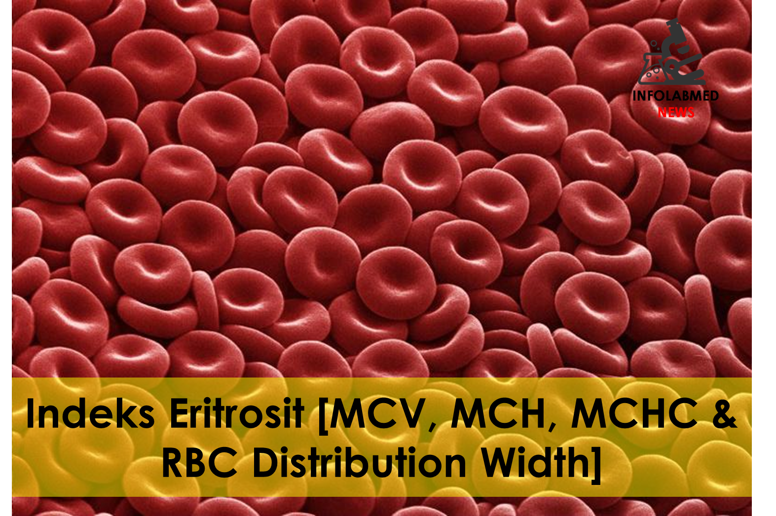Indeks Eritrosit [MCV, MCH, MCHC & RBC Distribution Width]