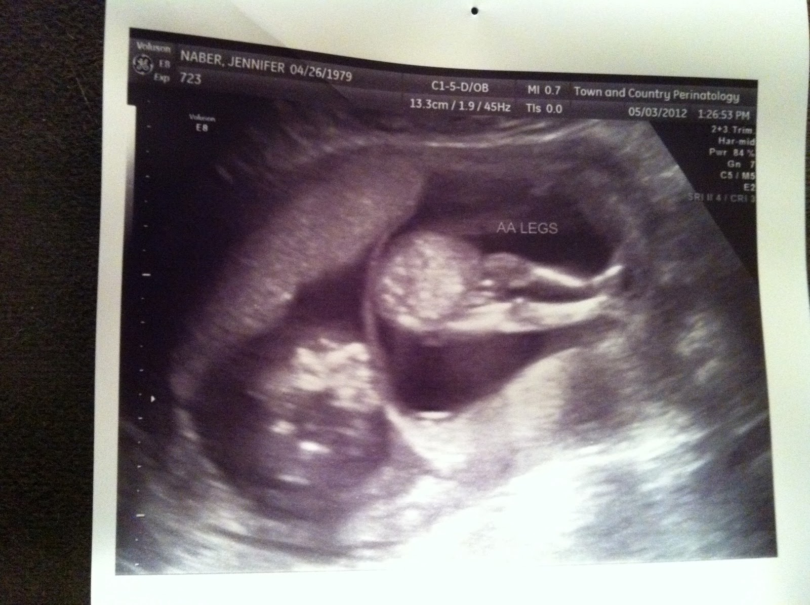 Our journey to be parents: 15 Weeks