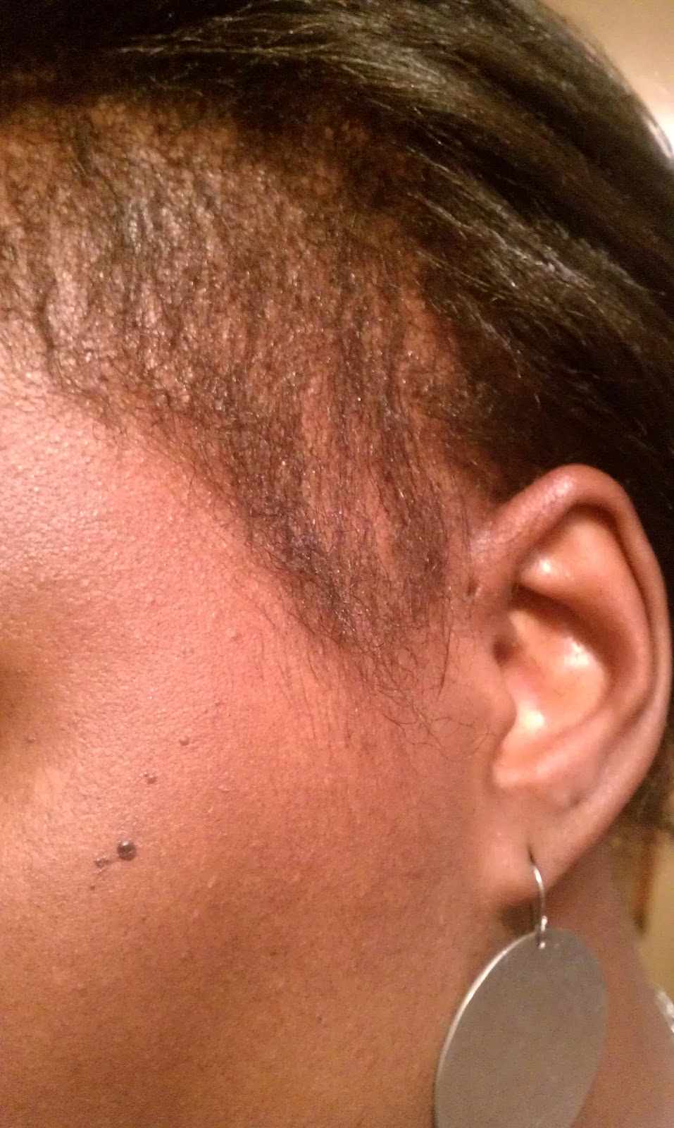 Tracking My Tresses: That Moment When Your Bald Sides Grow In!