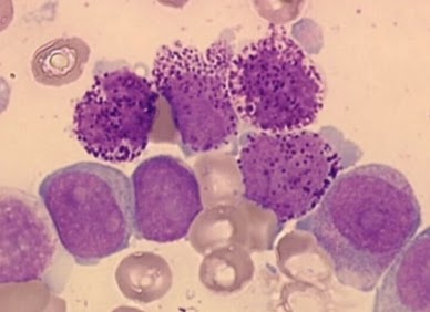 HEMATOLOGÍA: Serie Blanca