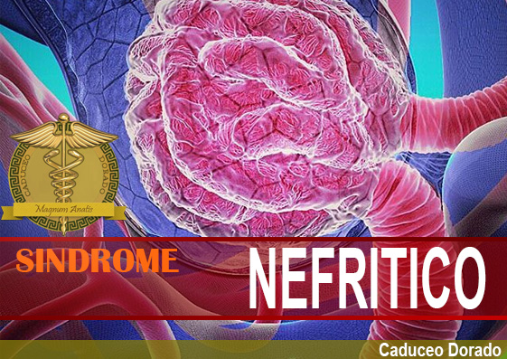 Caduceo Dorado: SINDROME NEFRITICO