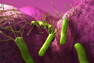 Helicobacter pylori - Microbiology Laboratory Turkey