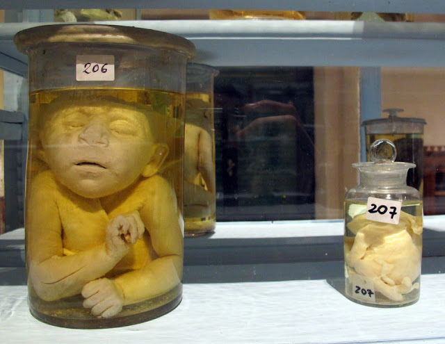 Good Nightmare...#52...The malformed fetuses museum in St. Petersburg...*