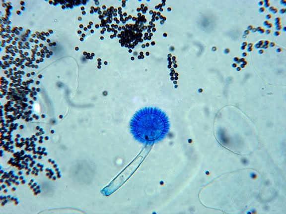 Fun With Microbiology (What's Buggin' You?): Aspergillus niger