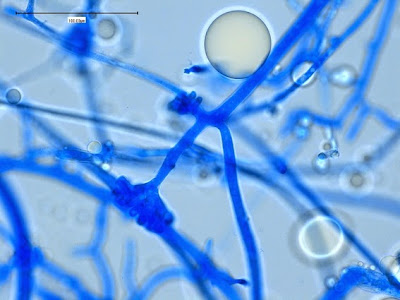 Fun With Microbiology (What's Buggin' You?): Apophysomyces elegans ...