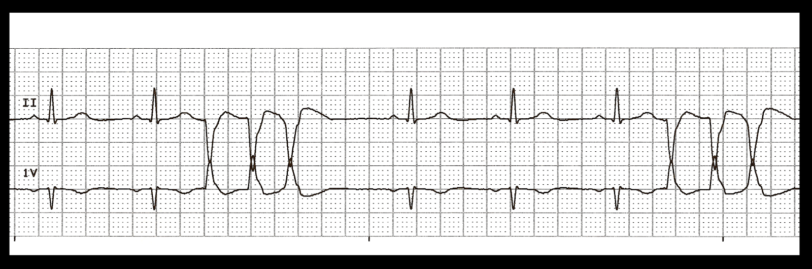 EKG Rhythm Quiz 220