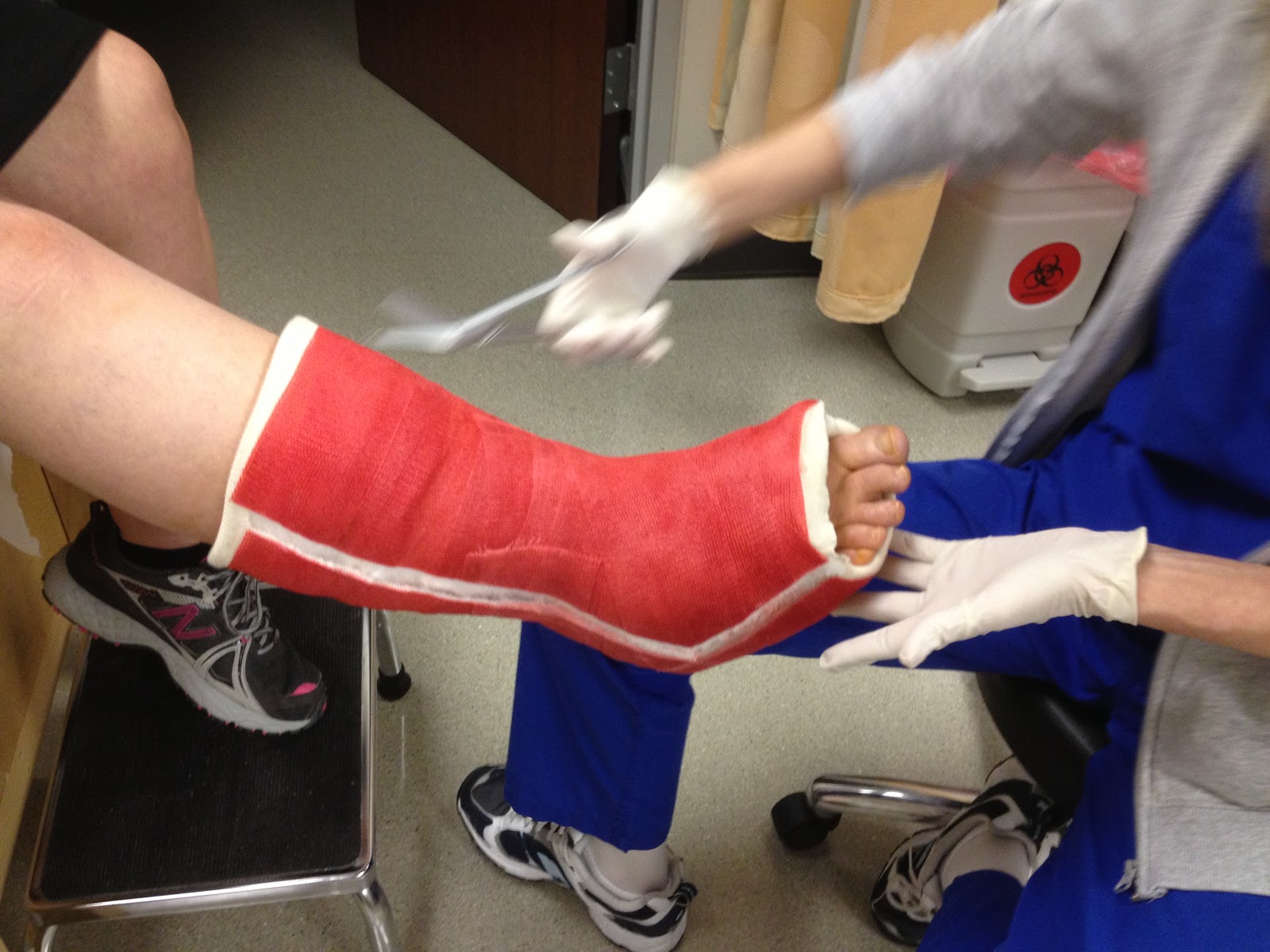 new-steps4ever...recovering from posterior tibial tendon injury : Shedding