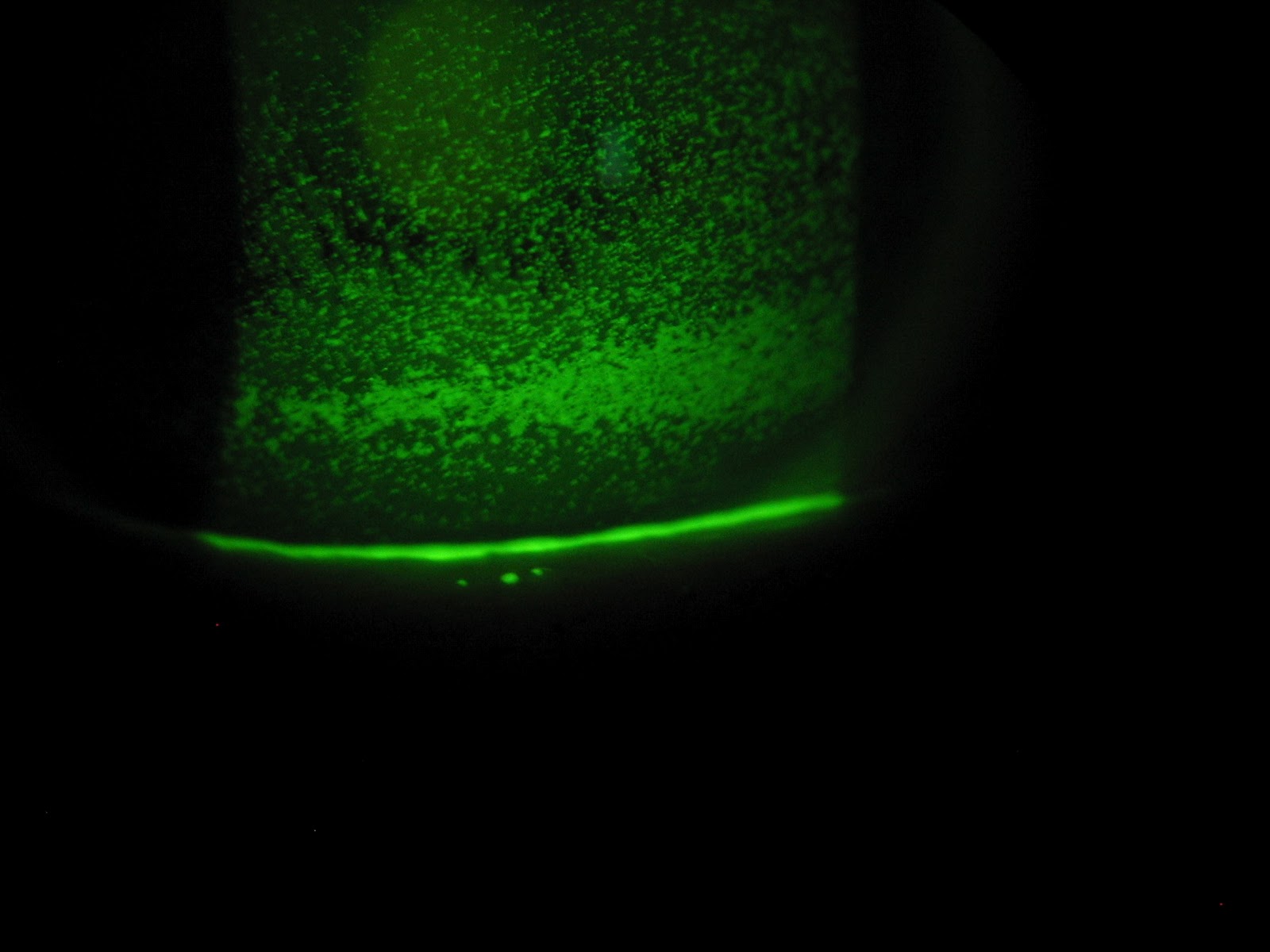 Alpine Vision Center