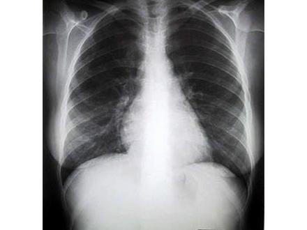 Curso de tórax normal y patológico