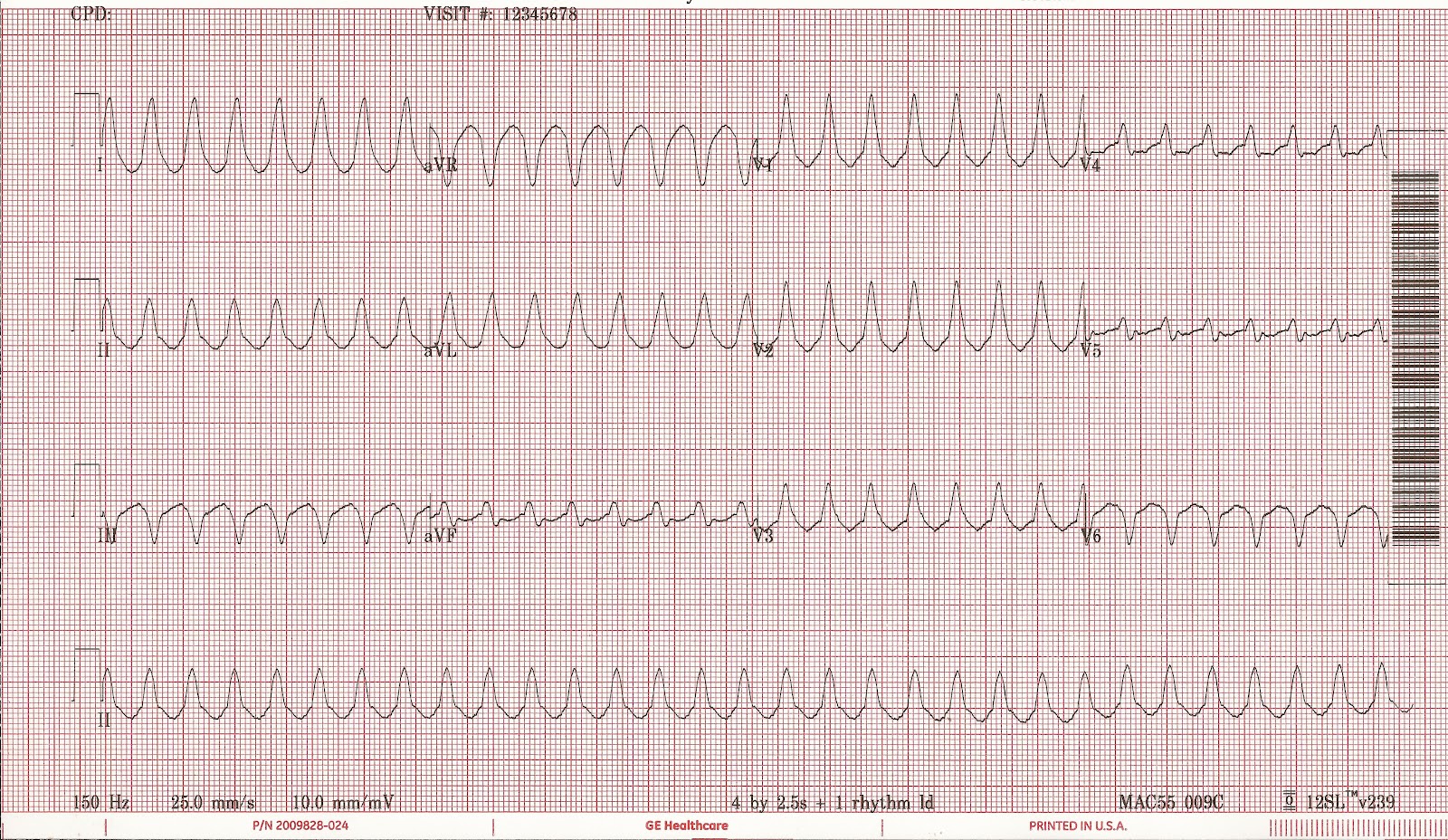 Megacode: Unstable Ventricular Tachycardia Part 1