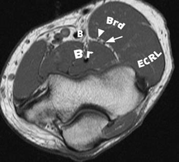MRI Musculo-Skeletal Section: Structures seen in each view