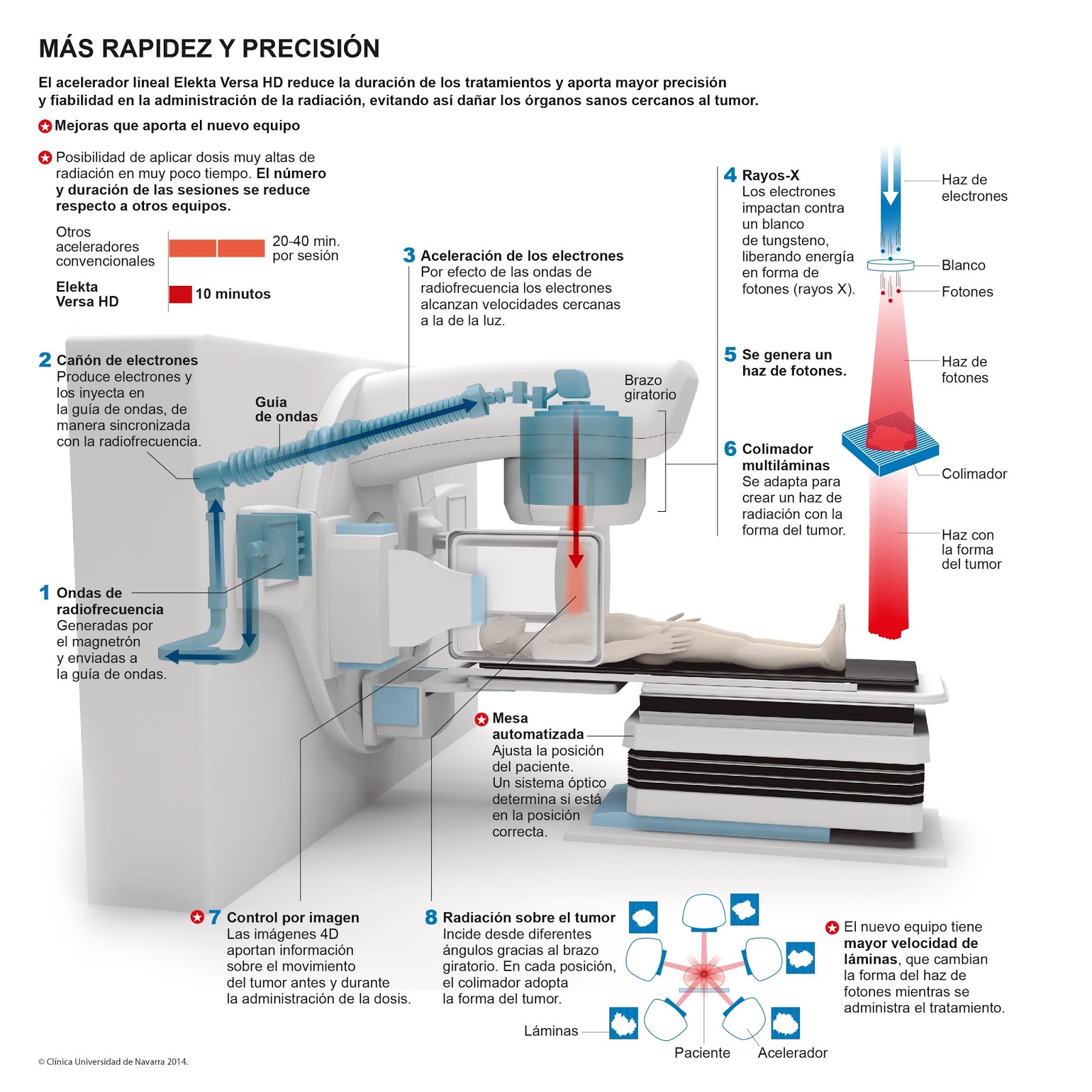 ASÍ FUNCIONA EL ACELERADOR LINEAL PARA LA RADIOTERAPIA (incluye vídeo ...