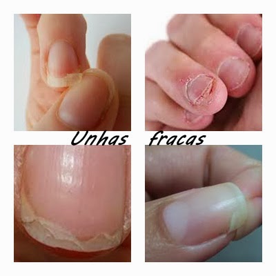 Divando Moda: Unhas fracas e quebradiças? Nunca mais!!