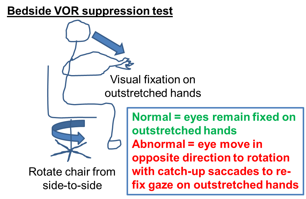 Teach Neurology: Vestibulo-ocular reflex (VOR)