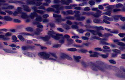 MoyinAdesanyaBiol 3500: The Human Appendix: My Favorite Organ: The ...