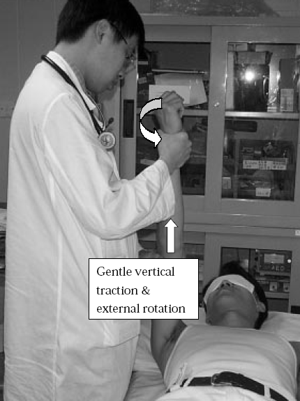 PG Medic: The Spaso technique-For Anterior Dislocation of Shoulder