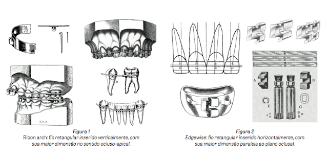 ORTODONTIA CONTEMPORÂNEA: Coluna OrtoTecnologia - Slot 0,018" ou 0,022 ...