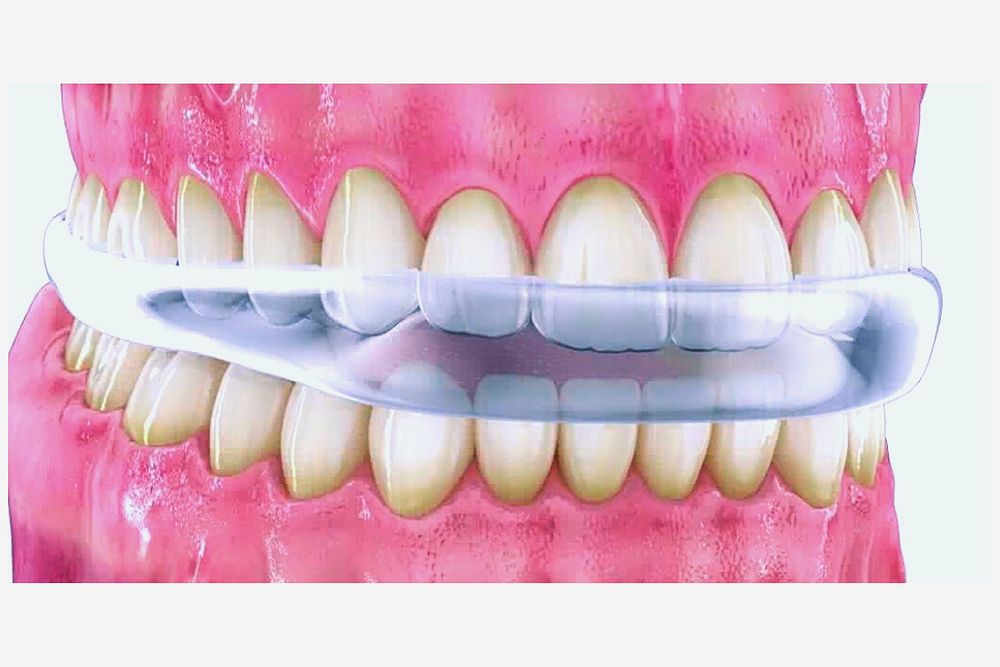 SALUD BUCAL: 8 recomendaciones para el cuidado oral en personas con ...