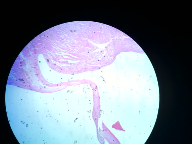 Ca - CaDo (Catatan Calon Dokter): Histologi Sistem Cardiovascular