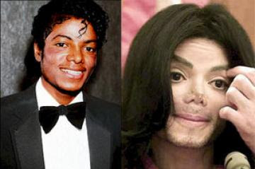Michael Jackson Plastic Surgery Before and After Nose Jobs and Skin ...