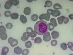 Hematologia Fichero USAC: 3. Mielocito