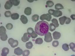 Hematologia Fichero USAC: 3. Mielocito