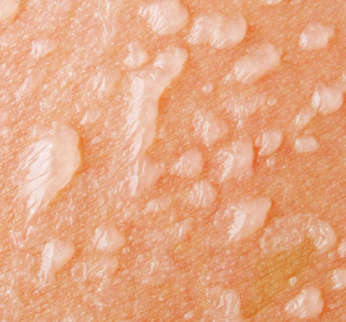 Island Urgent Care Blog: Wellness Wednesday: "Doctor, I had too much ...