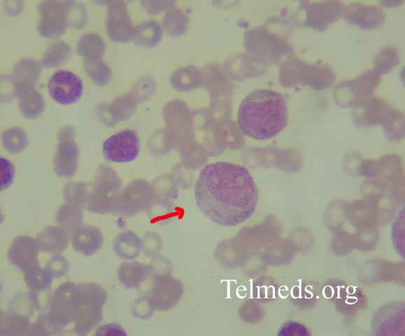 Hematología: Leucopoyesis