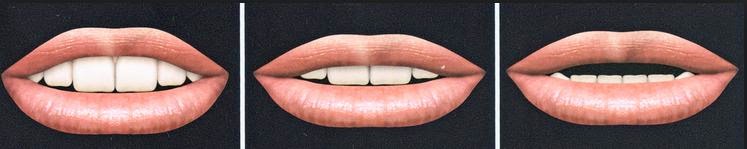 Omni Dental Group: Smile (Lip) Line