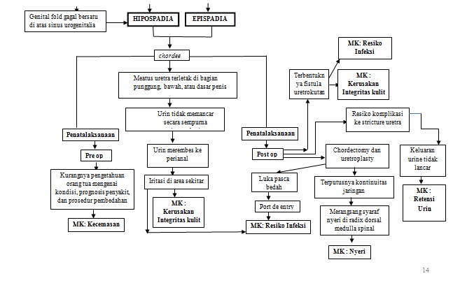 Febyana Dwi: ASKEP hipospadia / epispadia
