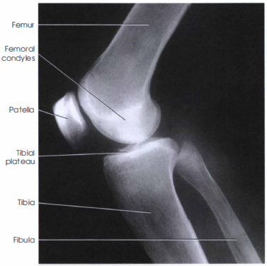 LATERAL-MEDIOLATERAL PROJECTION: KNEE - RadTechOnDuty