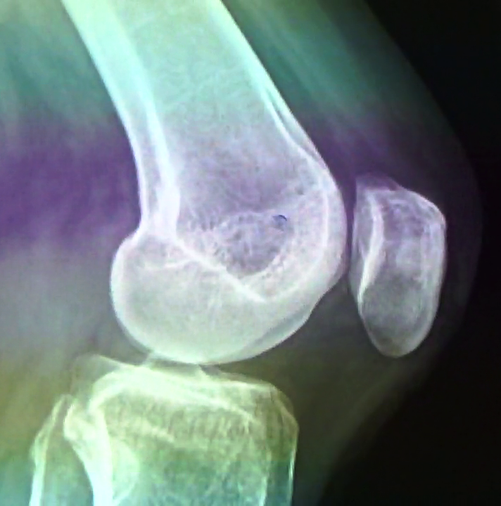 RADIOANATOMIA: abril 2015