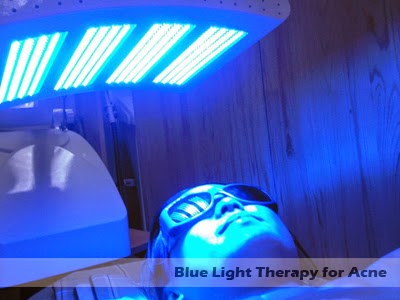 Blue Light Therapy for Acne: Isn't It Time To Look And Feel Better ...