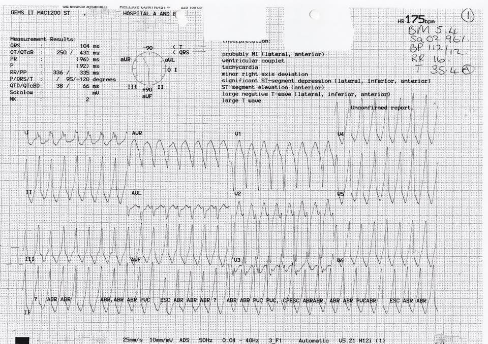 Jason Winter ECG Blog