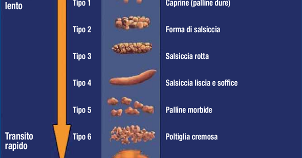 La forma delle feci, insieme al colore e alla consistenza, può rivelare ...