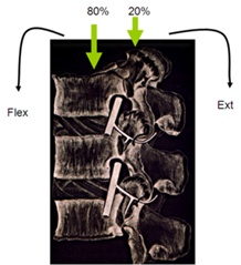 Move to Improve: What is a Lateral Shift & Why Does It Matter?
