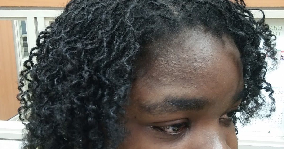 The Loc Addict: Why Microlocks