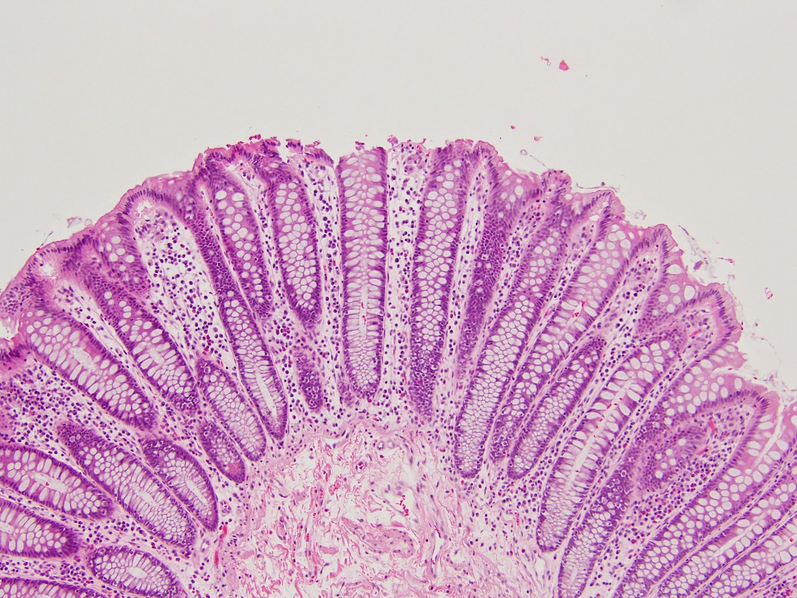 The Dancing Donkey: January 2015