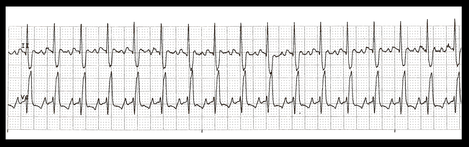 EKG Rhythm Quiz 235