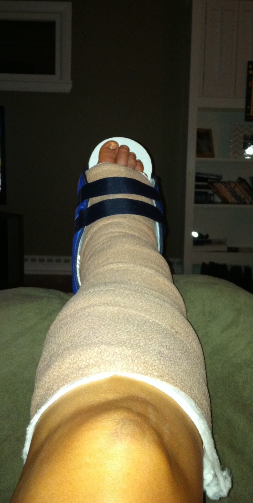 Miles, Miles, and More Miles...: Life with a new fast leg (surgery recap)!