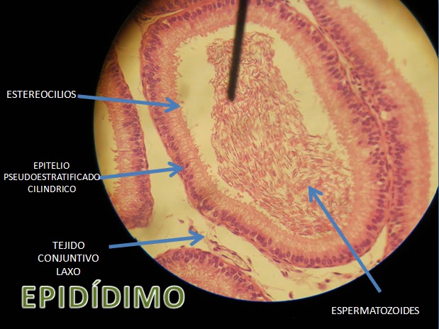 MÉDECINE: EPIDIDIMO - HISTOLOGÍA